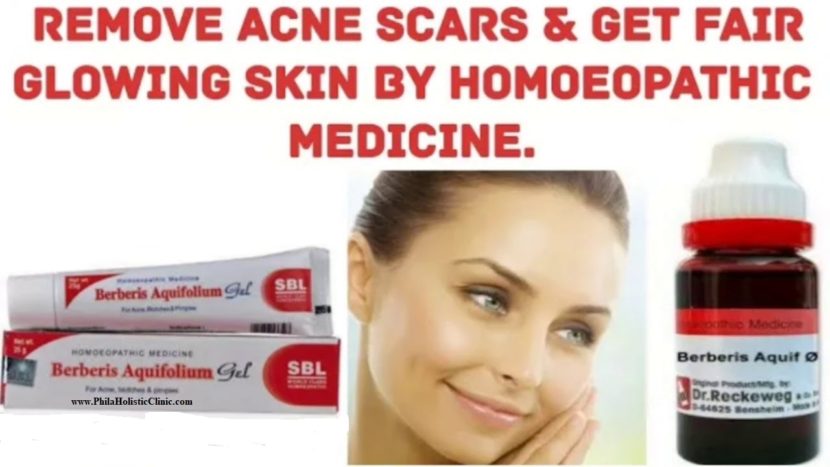 Treatment for Acne | Philadelphia Homeopathic Clinic| Dr. Tsan & Assoc.