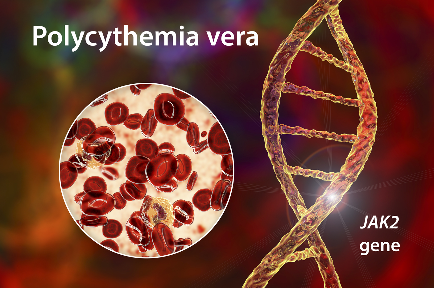 Polycythemia: Causes, Symptoms, and Holistic Treatment